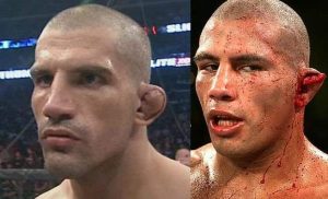 7 Worst UFC Cauliflower Ears - Warning: Not for the Weak!